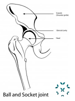 Avascular Necrosis and Lupus - Kaleidoscope Fighting Lupus